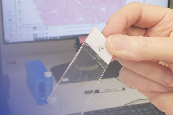 FFPE RNA Sequencing - SeqMatic